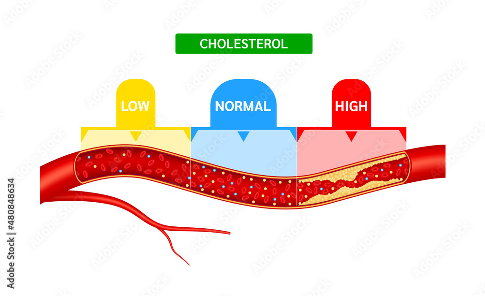 Cholesterol meter or scale comparison with HDL High density lipoprotein ...