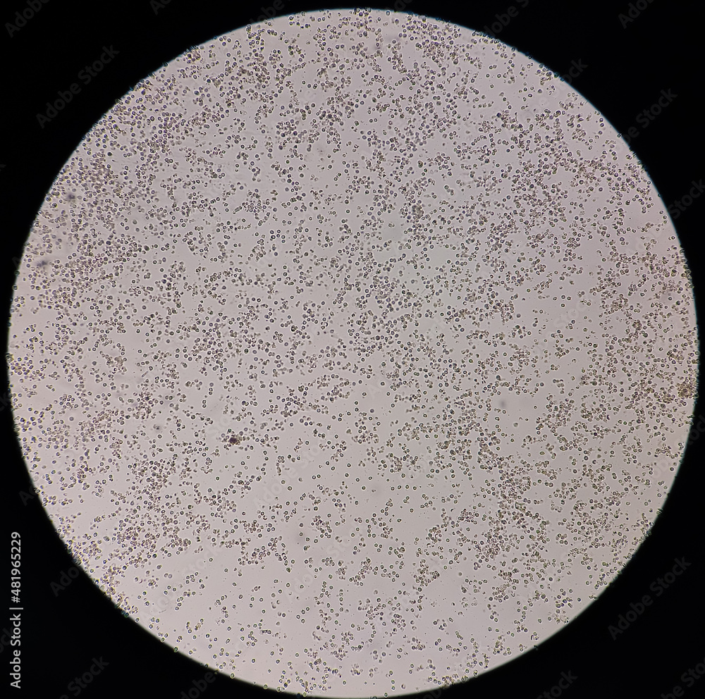 Foto de Stock Sperm morphology. Semen photo under microscope ...