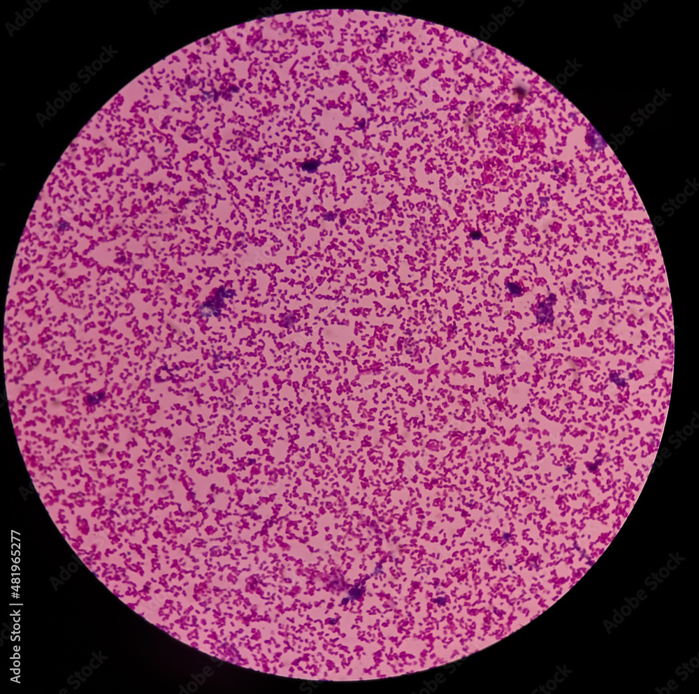 Enterobacter bacterium, gram-negative rod-shaped bacteria, facultative ...
