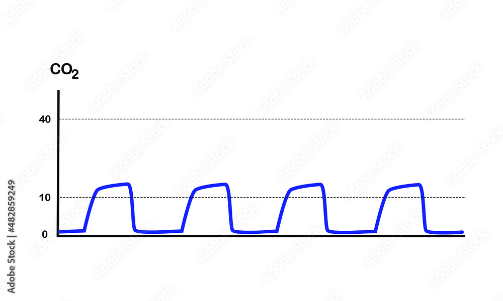 Vector de Stock capnography waveform during high quality CPR | Adobe Stock