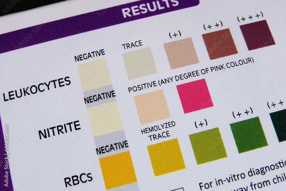 A urinary tract infection test result color chart printed on the back ...