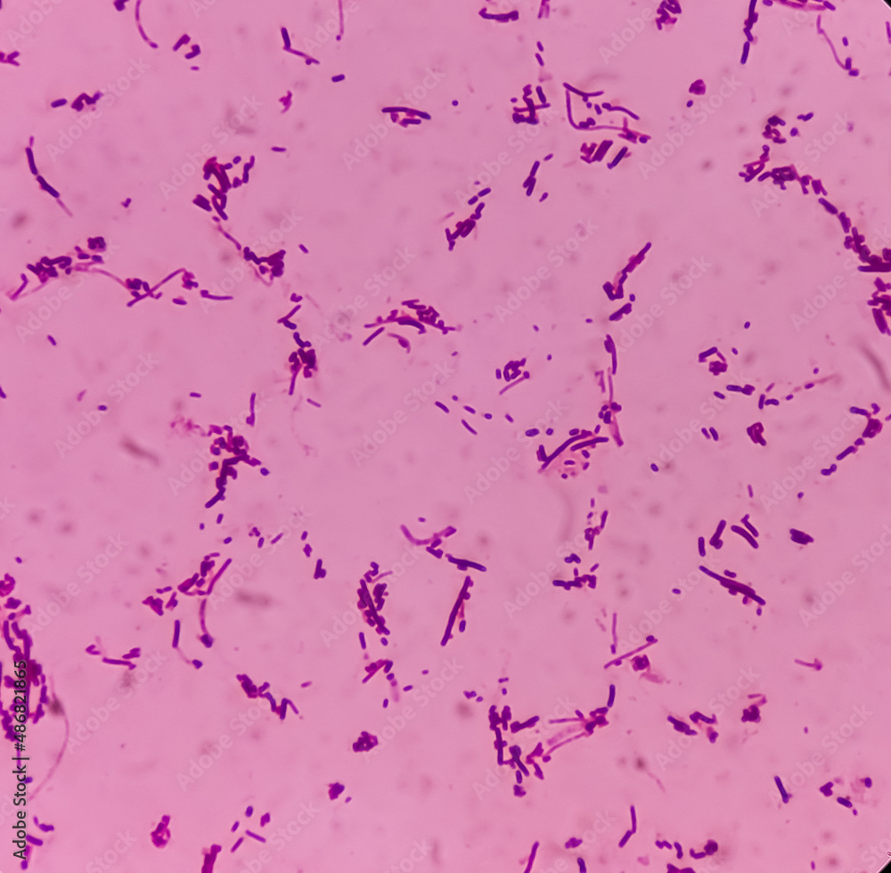 Salmonellosis: microscopic view of gram stained slide from blood agar ...