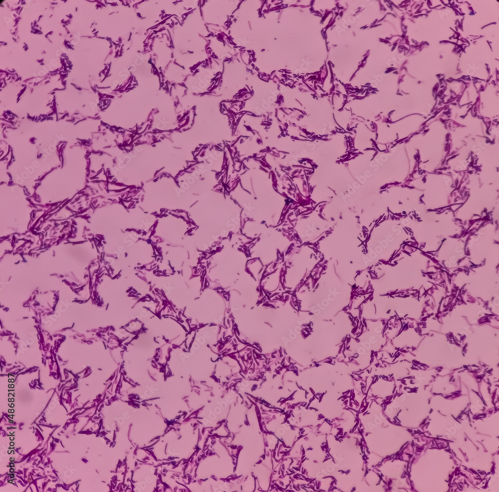 Salmonellosis: microscopic view of gram stained slide from blood agar ...