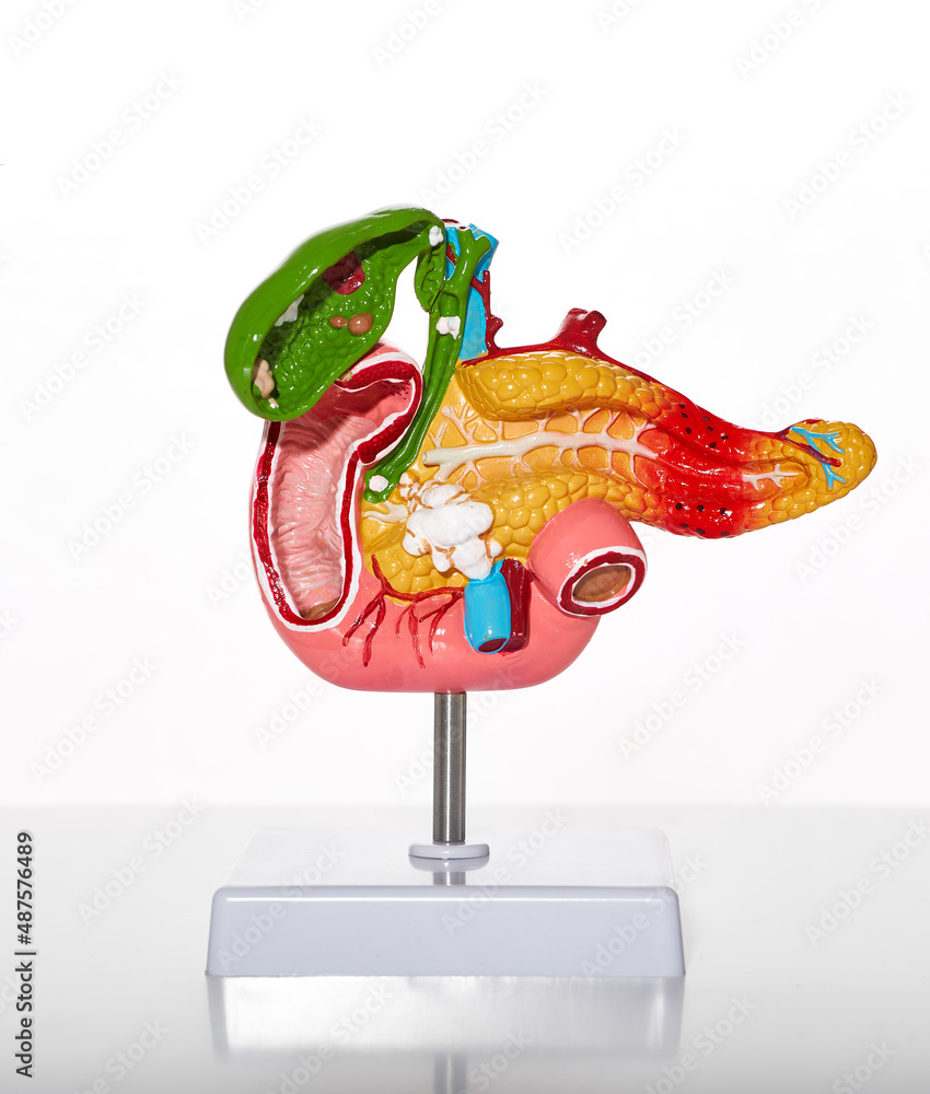 Anatomical model of human pancreas and gallbladder with pathologies and ...