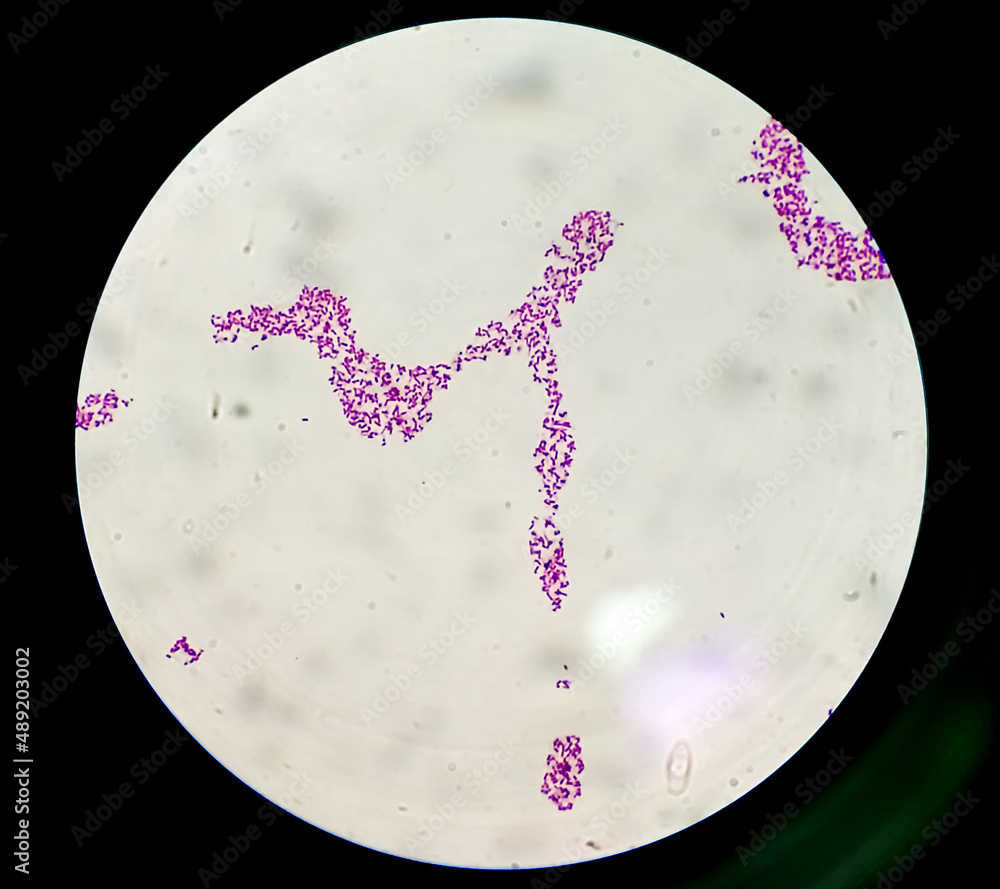 Blood agar bacterial colonies gram stained microscopic show Salmonella ...