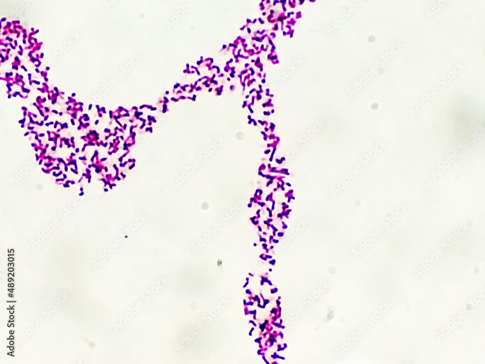Blood agar bacterial colonies gram stained microscopic show Salmonella ...