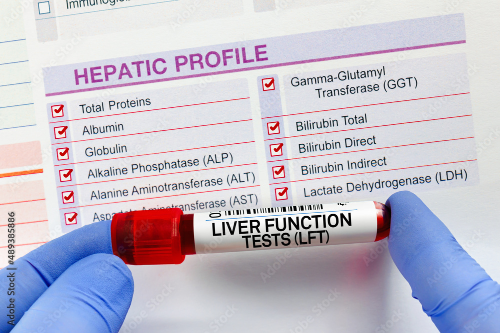 Blood tube test with requisition form for Liver Function Tests LFT ...