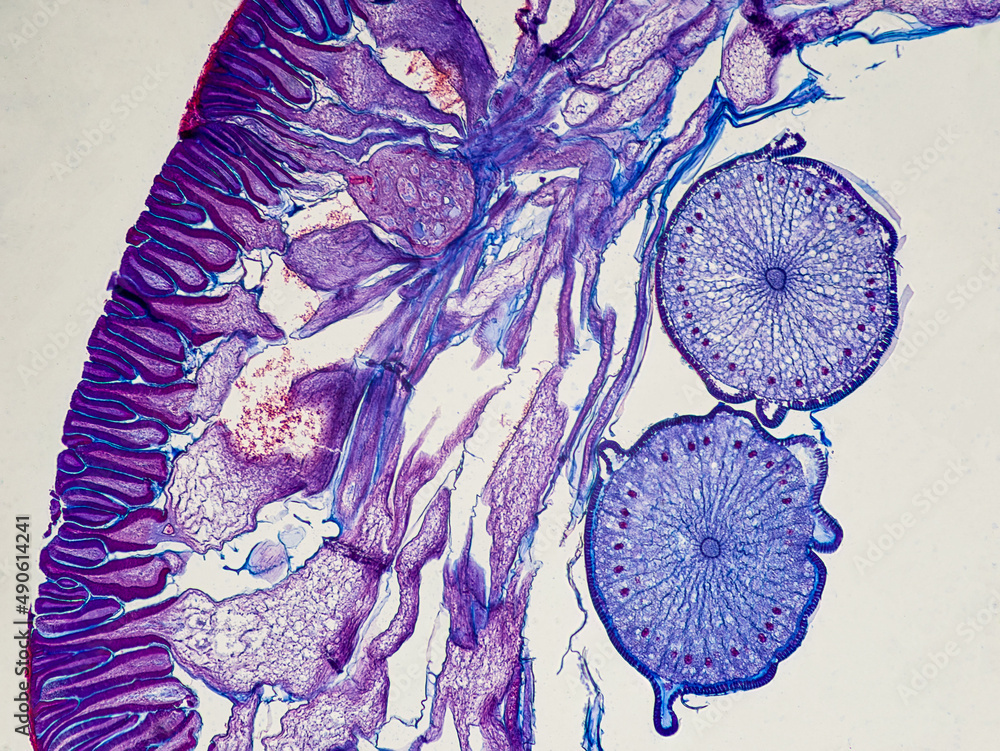 ascaris megalocephala cross section under the microscope showing its ...