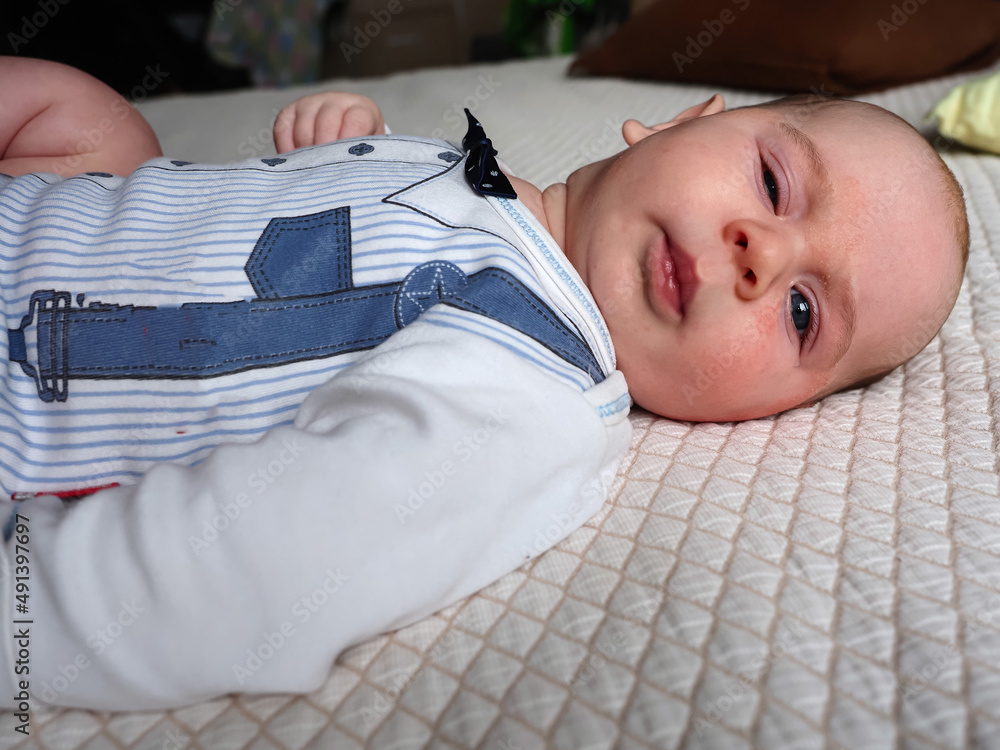 Atopic dermatitis child skin problem Stock Photo | Adobe Stock