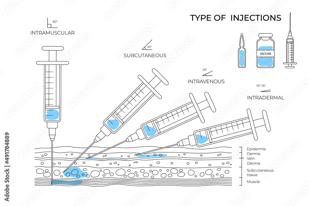Types of injections. Guide to injecting vaccines into skin. Medical ...