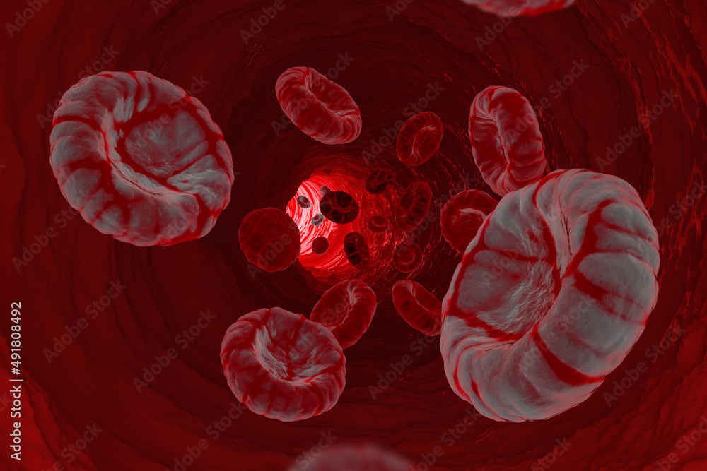 Leukemia cancer and virus white hemoglobin Serious disease red blood ...