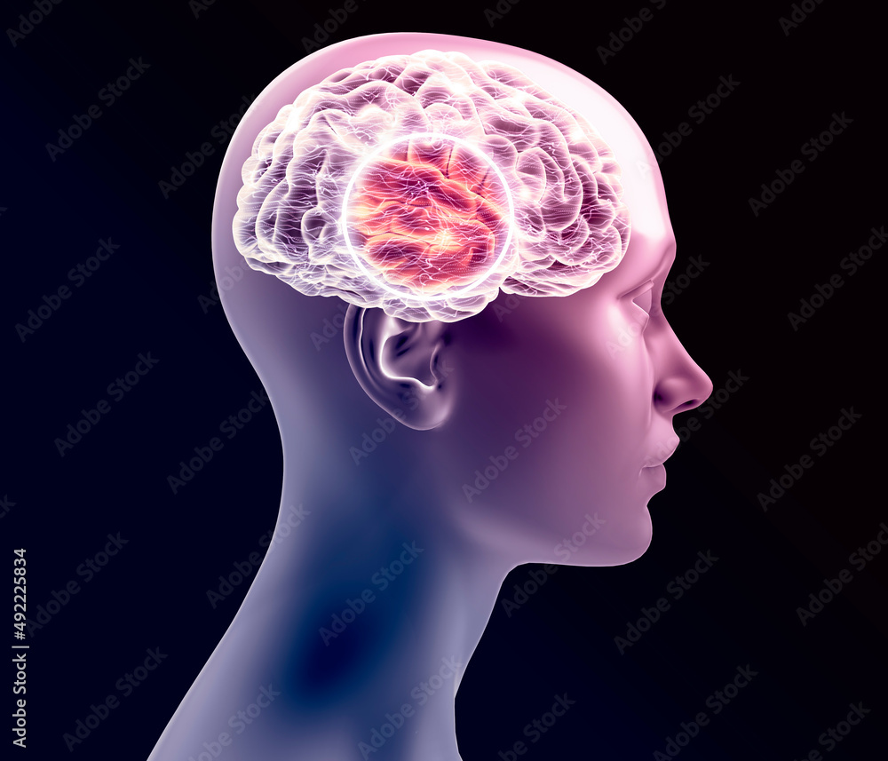 Woman and human brain seen in profile. X-rays. Degenerative disease ...