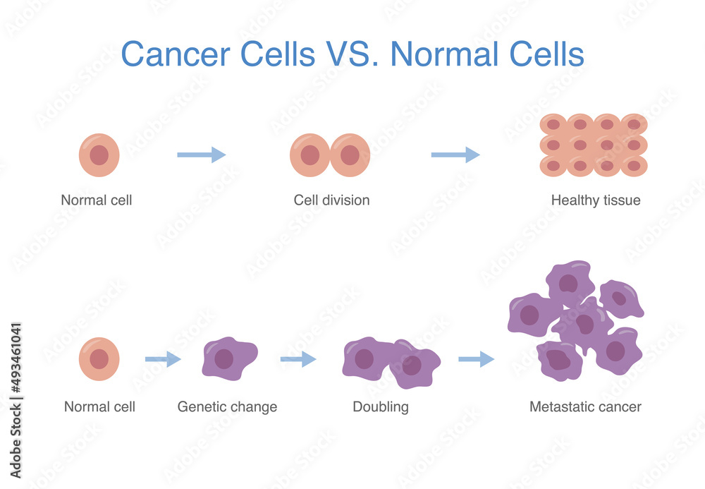 Compare between devenlop of healthy cell and cancer cell. Medical and ...