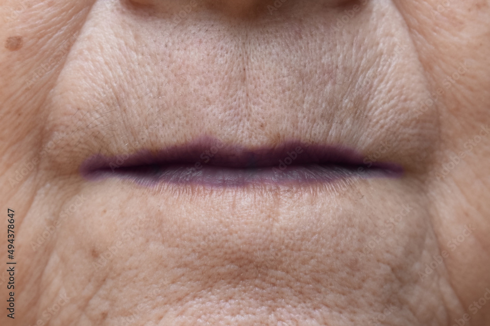 Cyanotic lips or central cyanosis at Asian old woman Stock Photo ...