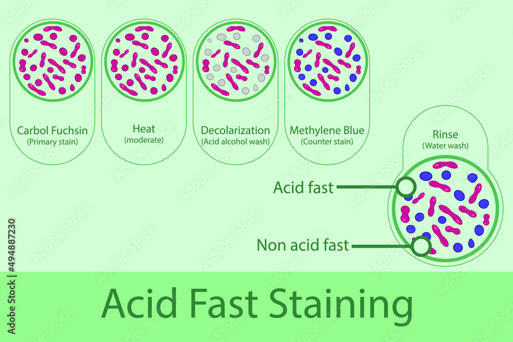 Acid fast staining technique steps diagram, using Carbol fuchsine and methylene blue vector ...