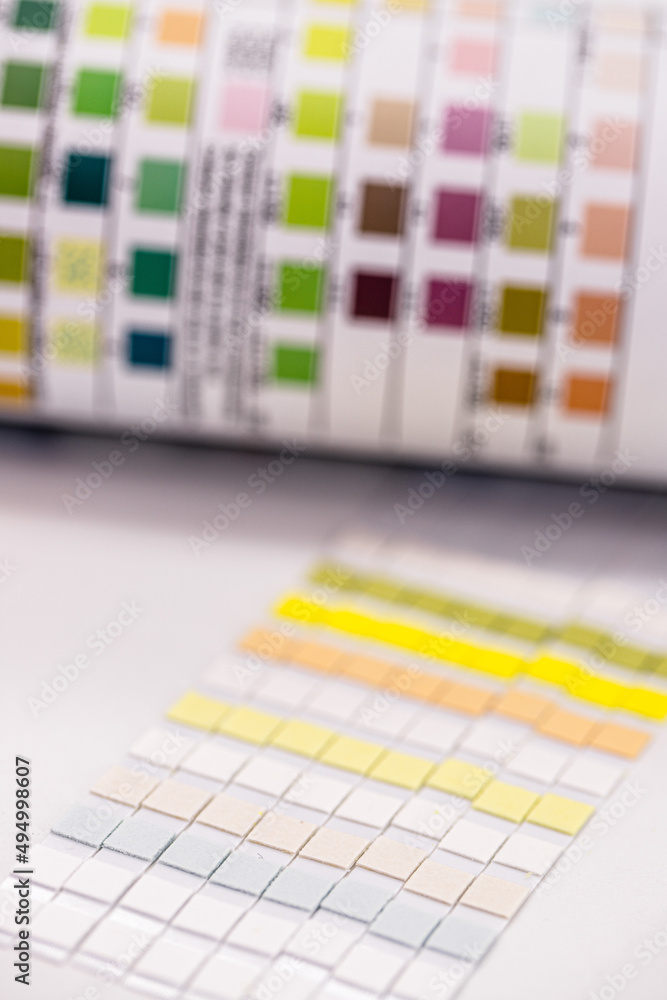 reagent strips used in urinalysis to analyze Leukocytes, Urobilinogen ...