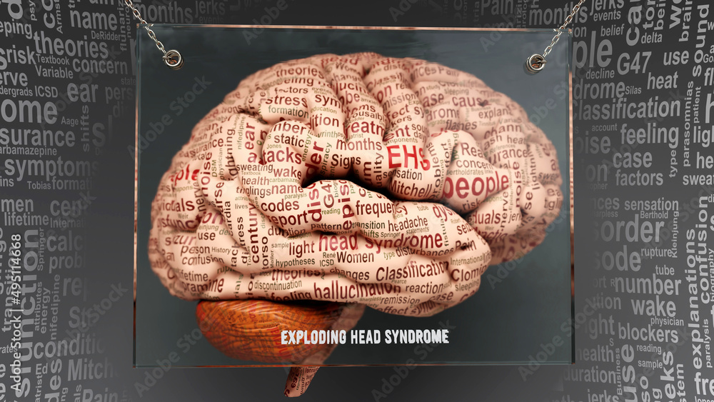 Exploding head syndrome anatomy - its causes and effects projected on a ...