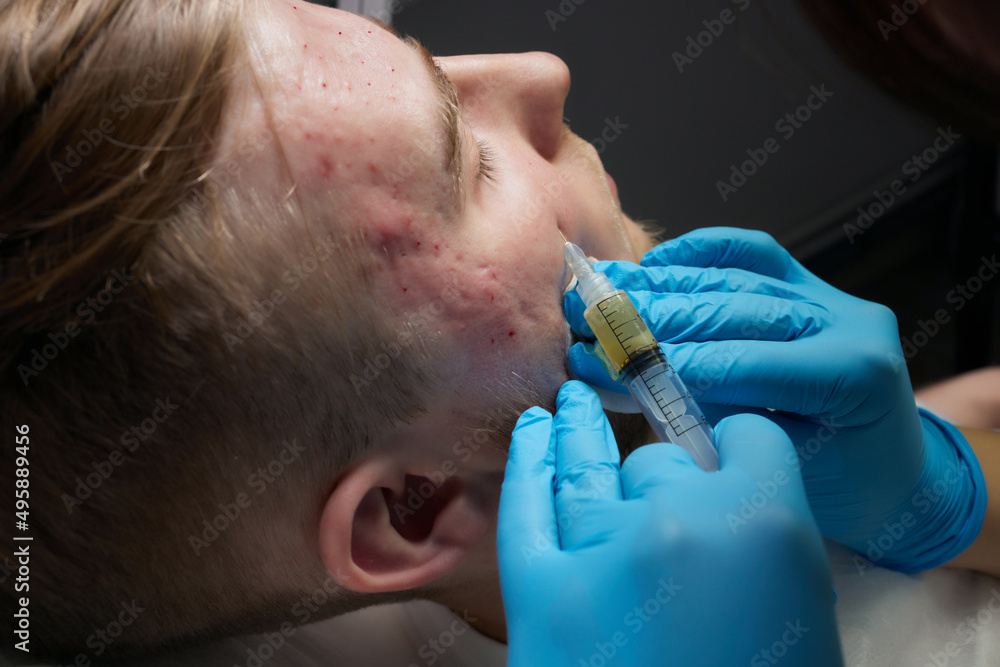 Injection at spa salon. Doctor hands in gloves. Closeup. Pretty male ...