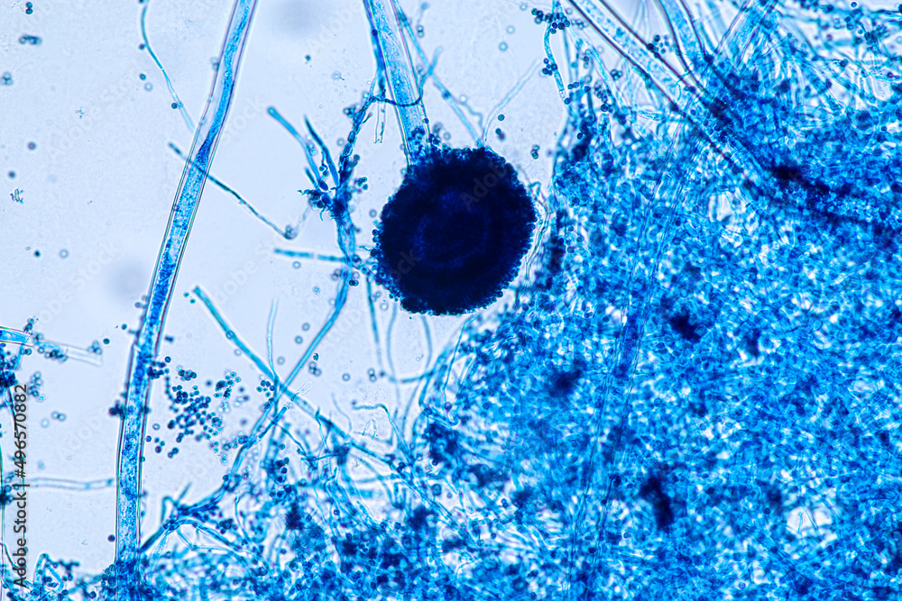 Стоковое фото «Aspergillus niger and Aspergillus oryzae (mold) under ...