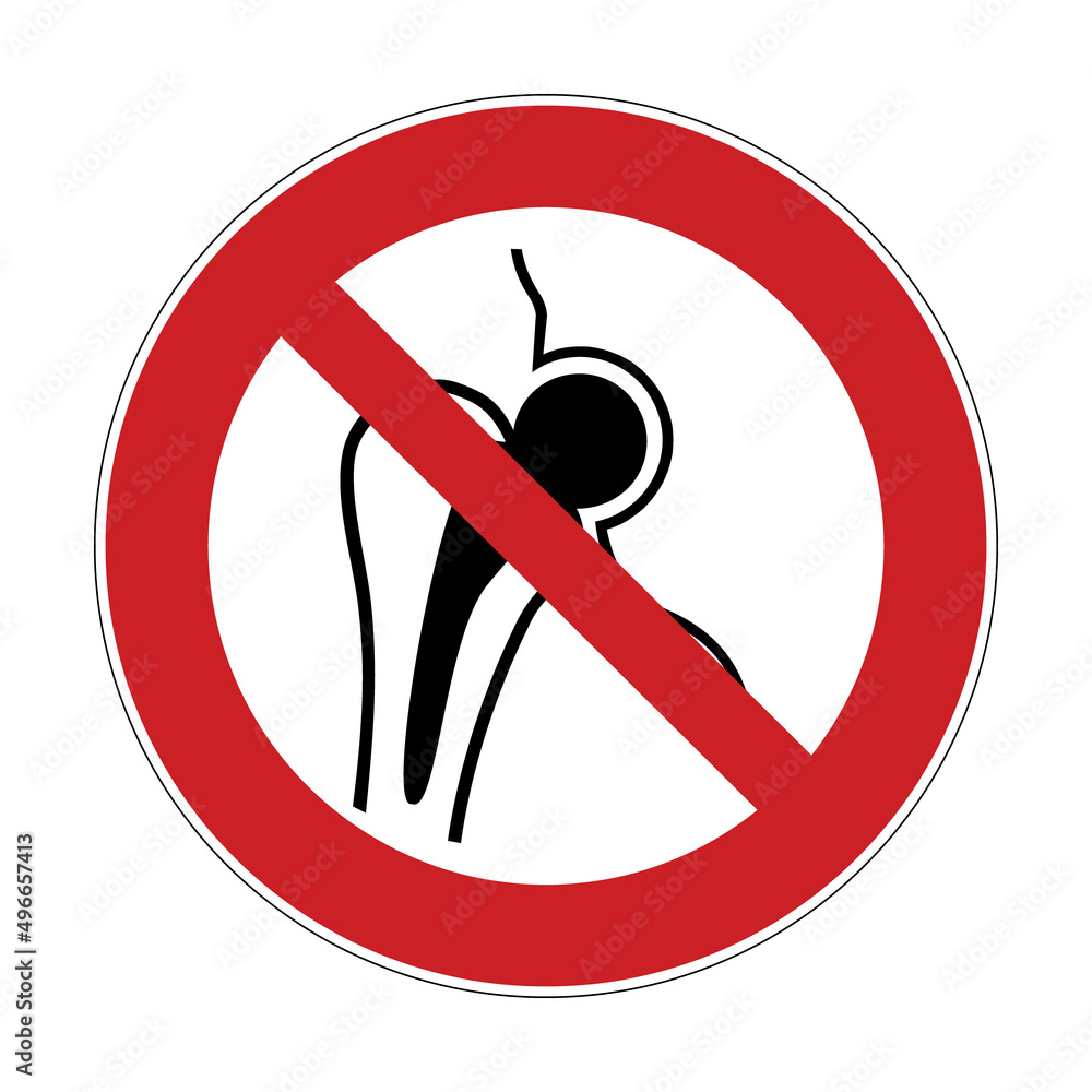 No access for people with metallic implant sign. Vector illustration of ...
