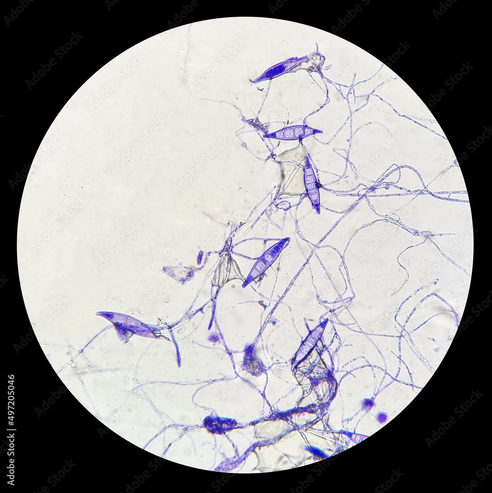 Microscopic finding shows macroconidia of Microsporum canis in dog with ...