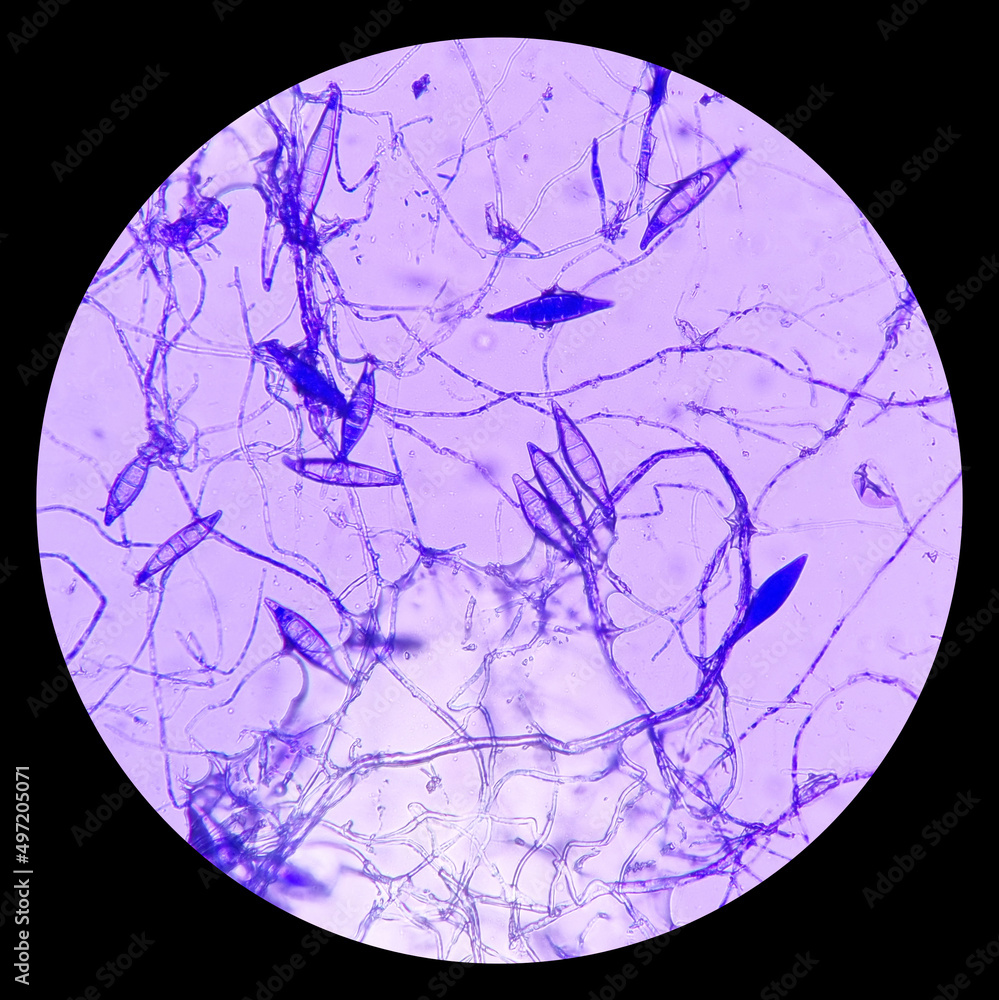 Microscopic finding shows macroconidia of Microsporum canis in dog with ...