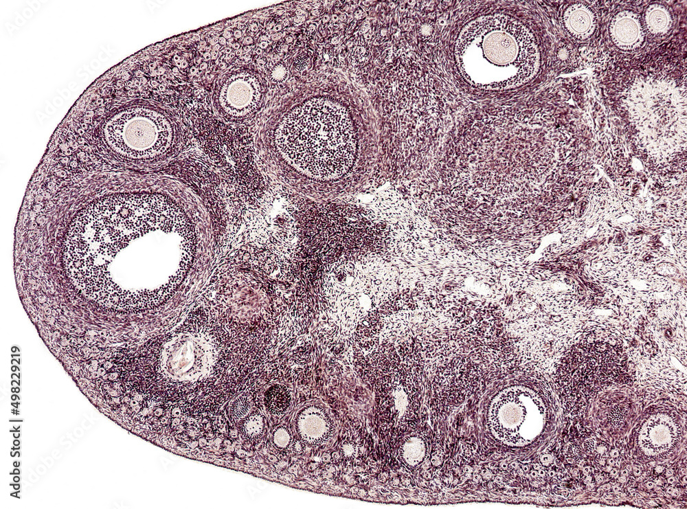 Ovary (cross section) showing histology and maturation of follicle ...