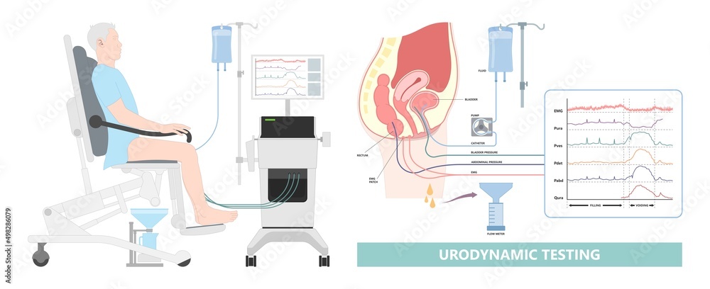 urination study test urine leak EMG Urethral flow often tract exam ...