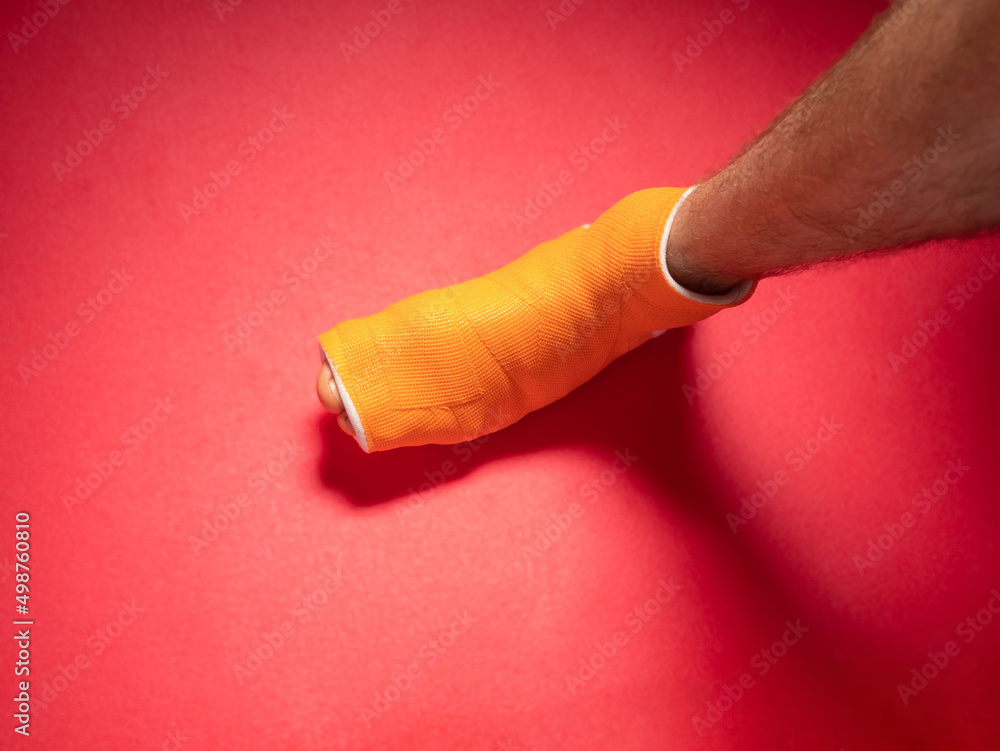 Foot with broken toe bone in orange fiberglass cast pink background ...