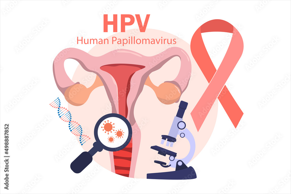 HPV (Human Papillomavirus) Cervical cancer screening and treatment, PAP ...