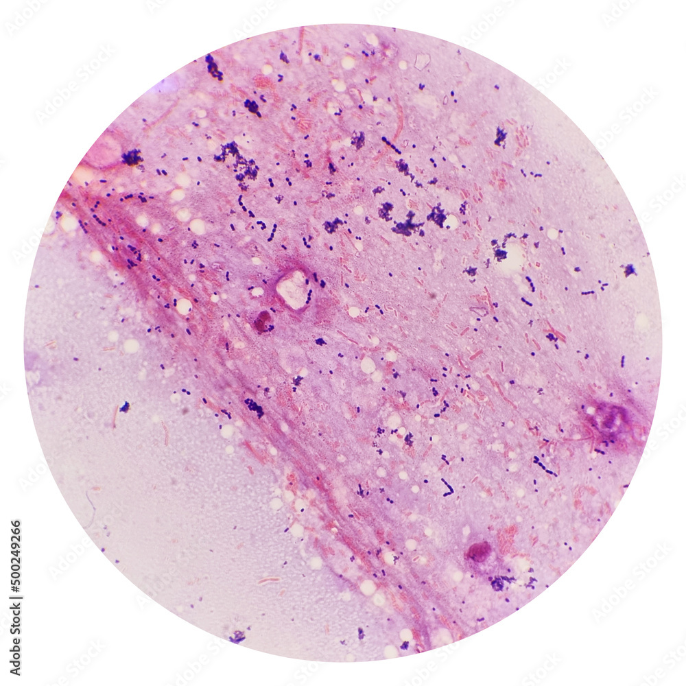 Urinary Tract Infection Bacteria Microscope