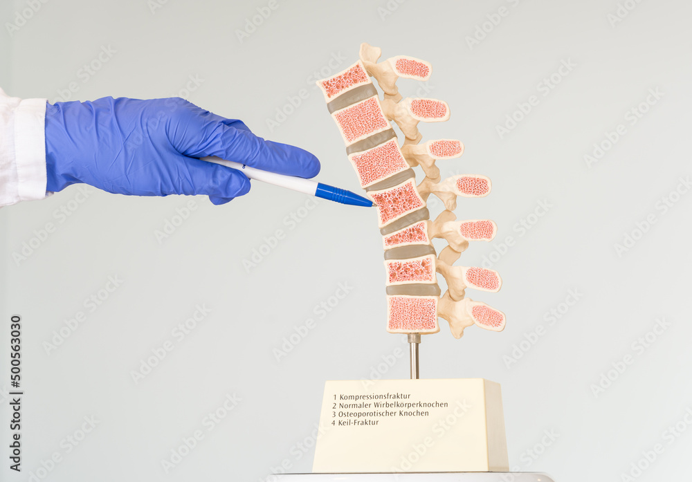 The doctor shows a model of the human spine, which shows various ...