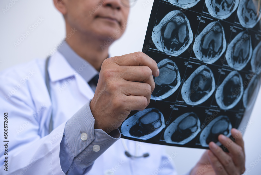 Orthopedic surgeon doctor examining patient's knee joint x-ray films ...