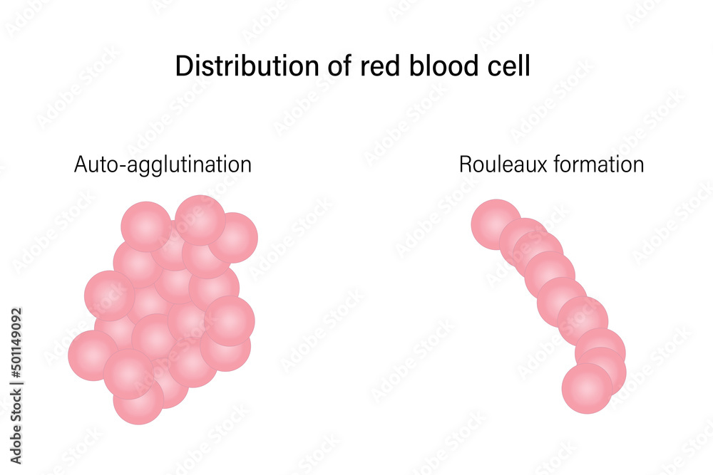 Red Blood Cell Agglutination