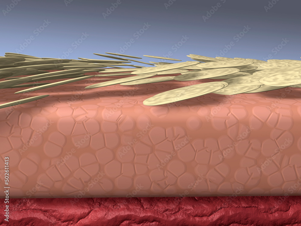 Dry skin flaking off from the epidermis. Epidermal squamous cells ...