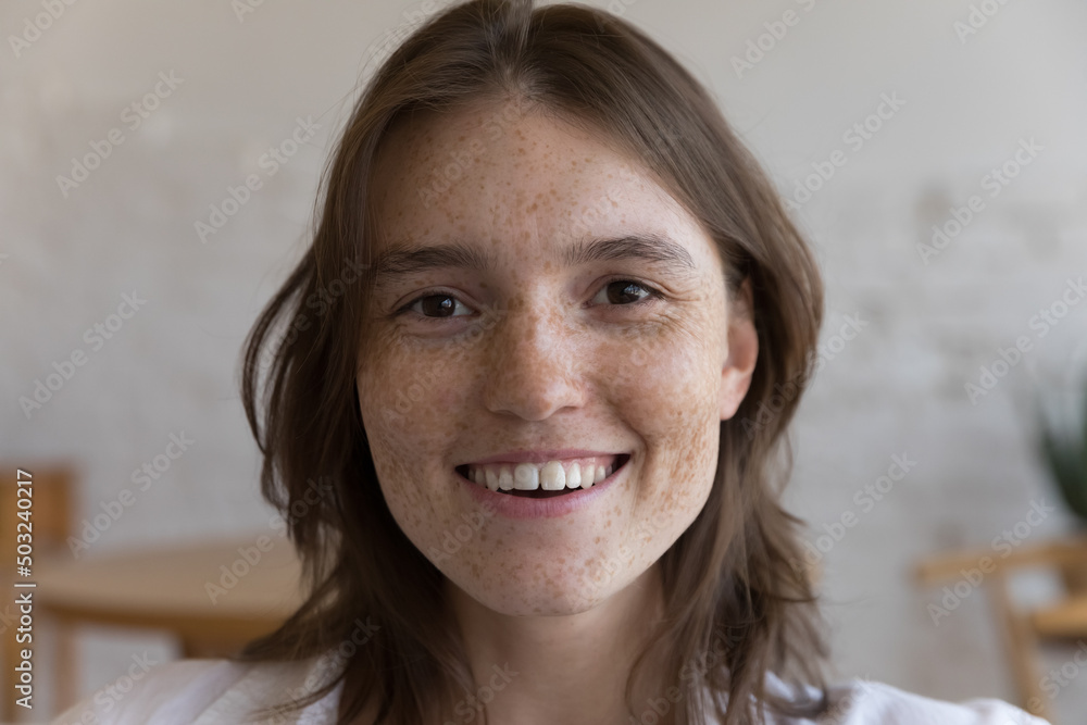 Photo Stock Freckled face of happy teen girl without makeup looking at ...