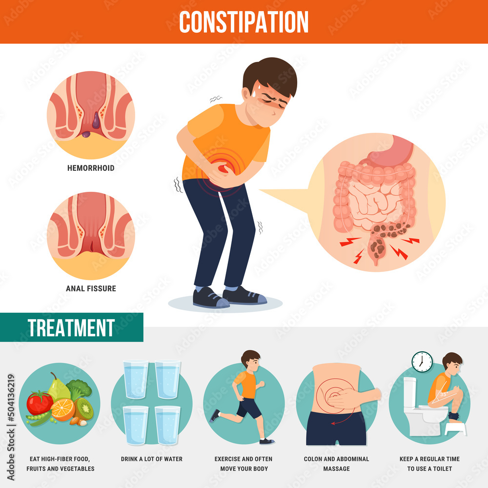 Infographic of Constipation Symptoms and how to treatment. Stock Vector ...