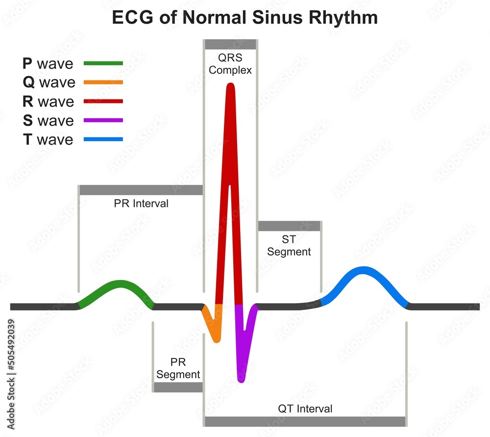 heart rhythm chart