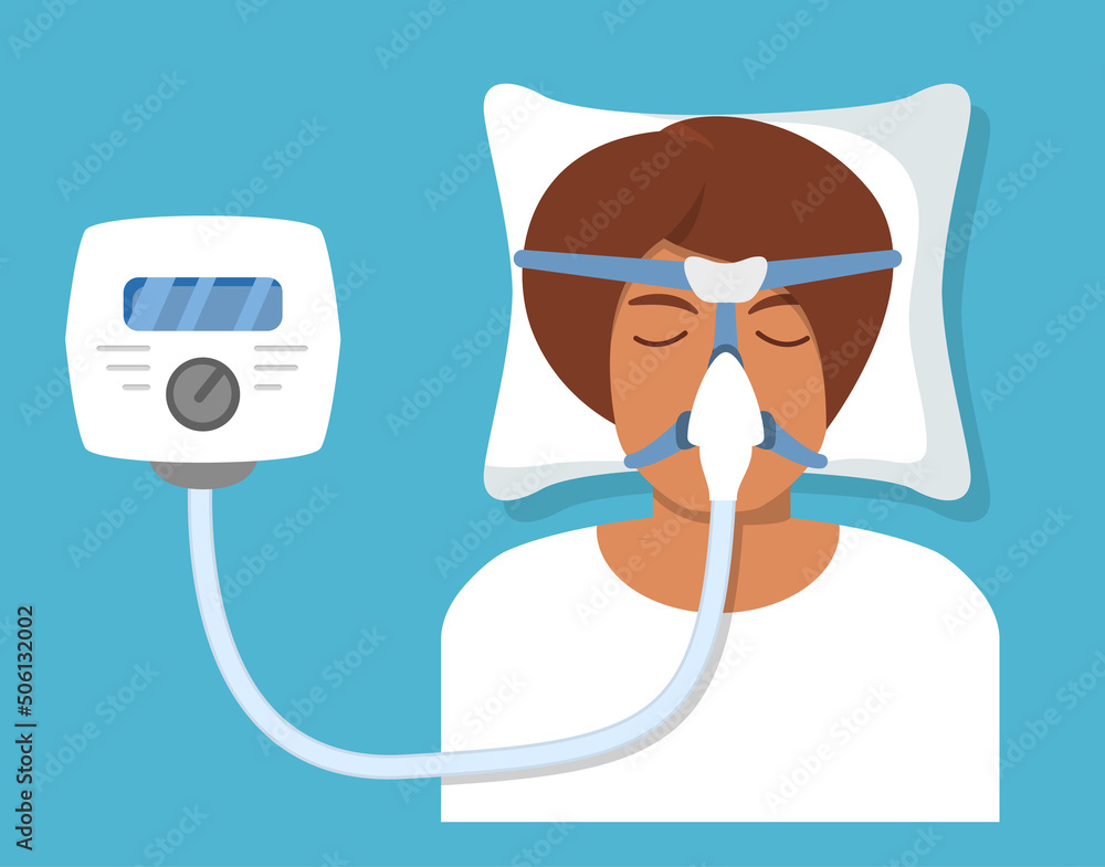 Continuous positive airway pressure.Obstructive sleep apnea.Man lying ...