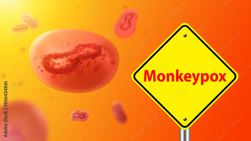 Monkeypox danger of infection. Cells with virus on orange. Yellow ...