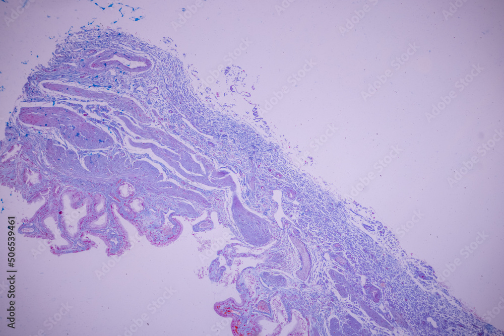 Columnar epithelium of human gall bladder under the microscope in Lab ...