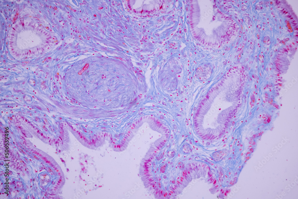 Columnar epithelium of human gall bladder under the microscope in Lab ...