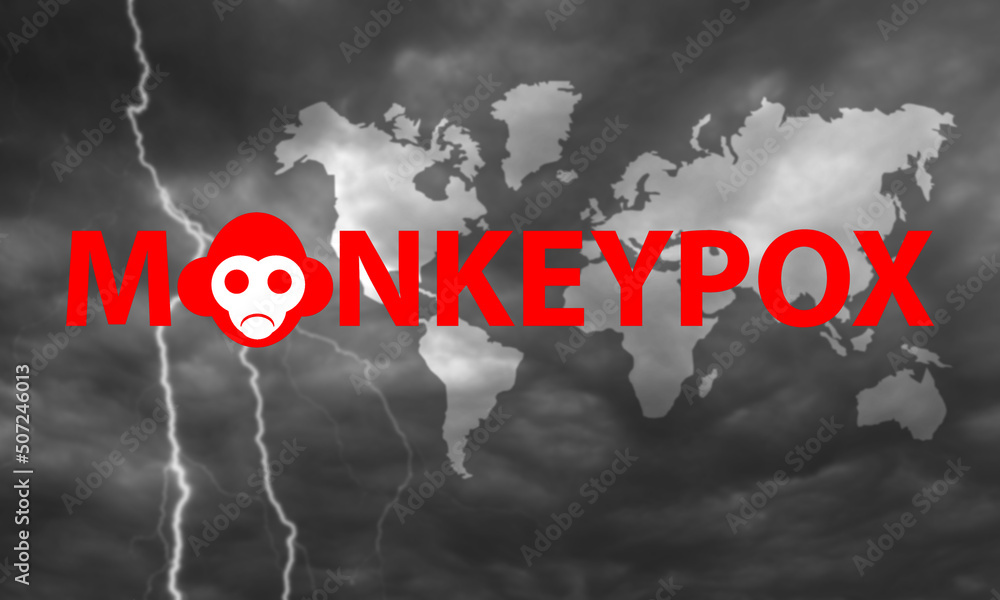 Monkeypox epidemic. Outbreak of dangerous virus. Monkeypox fever in ...