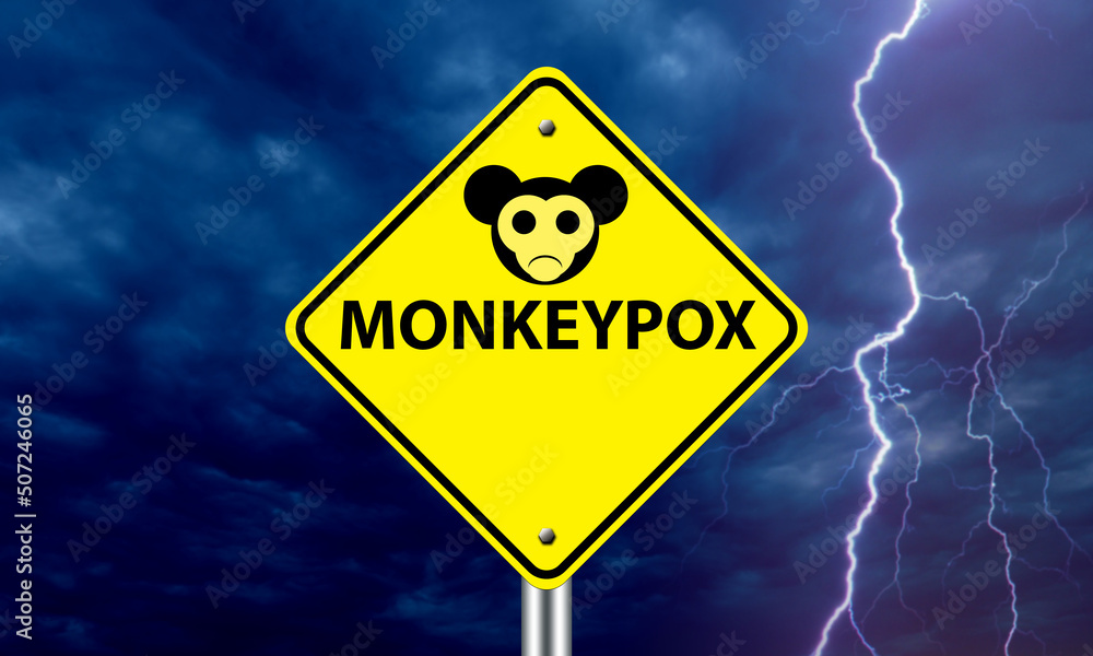 Monkeypox hazard. Warning yellow road sign. Monkeypox risk of infection ...