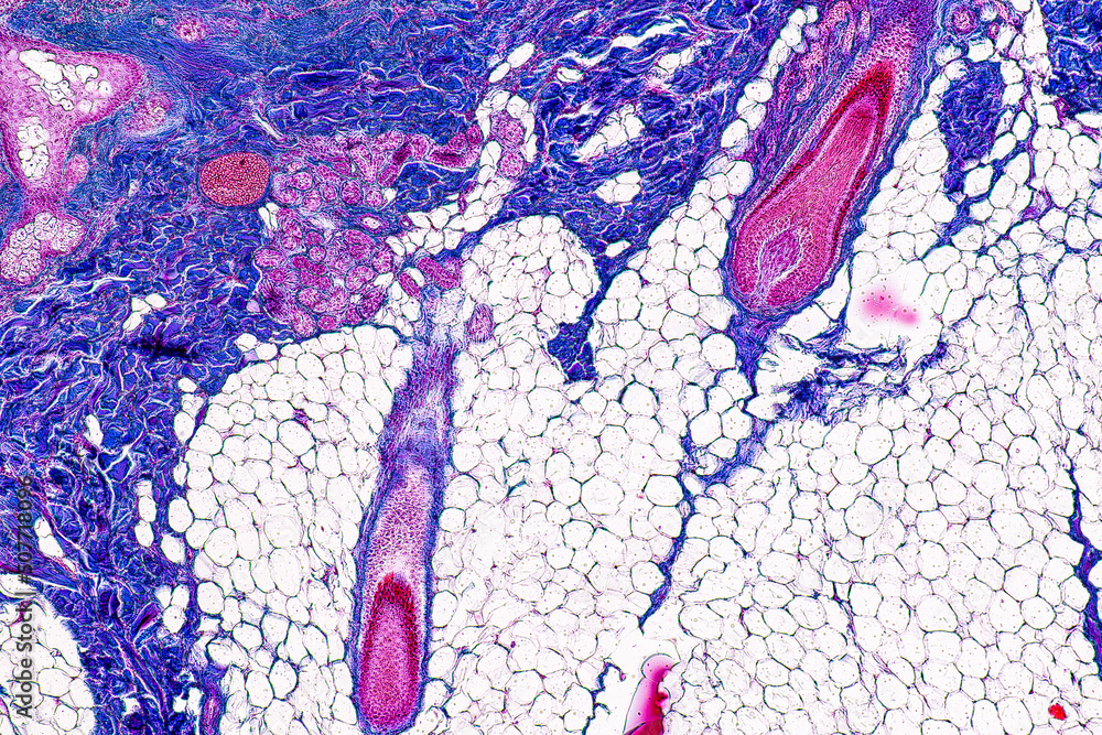 Scalp and hair follicles of human under the microscope in Lab. Stock ...