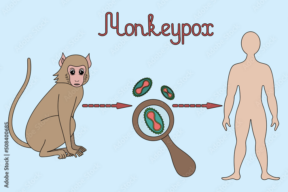 Monkeypox. Diagram of human infection with the smallpox virus. Monkey ...
