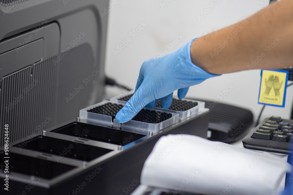 Medical Scientists Are Examining Hpv Dna In Specimens From Liquid Based Cervical Cells Stock
