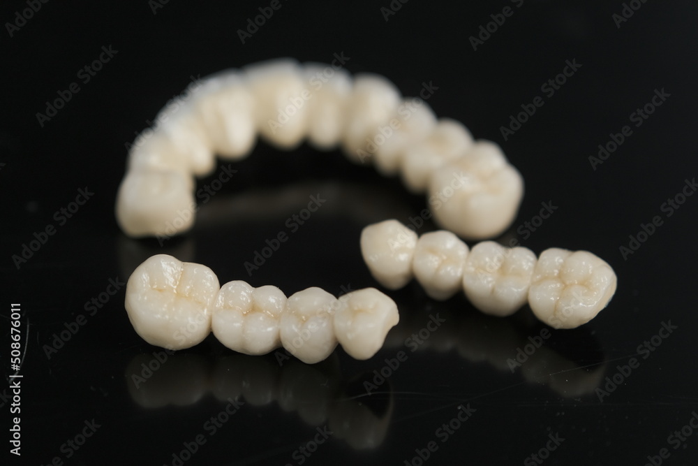 Dental ceramic bridge on isolated wite background. Metal free ceramic ...