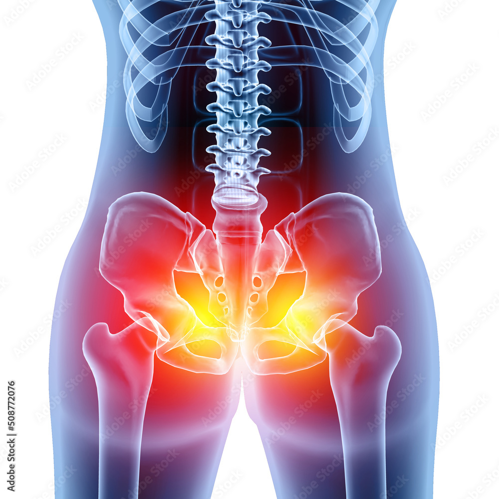 Bones of the pelvis and hip, human anatomy, femur bone joint pain, X ...
