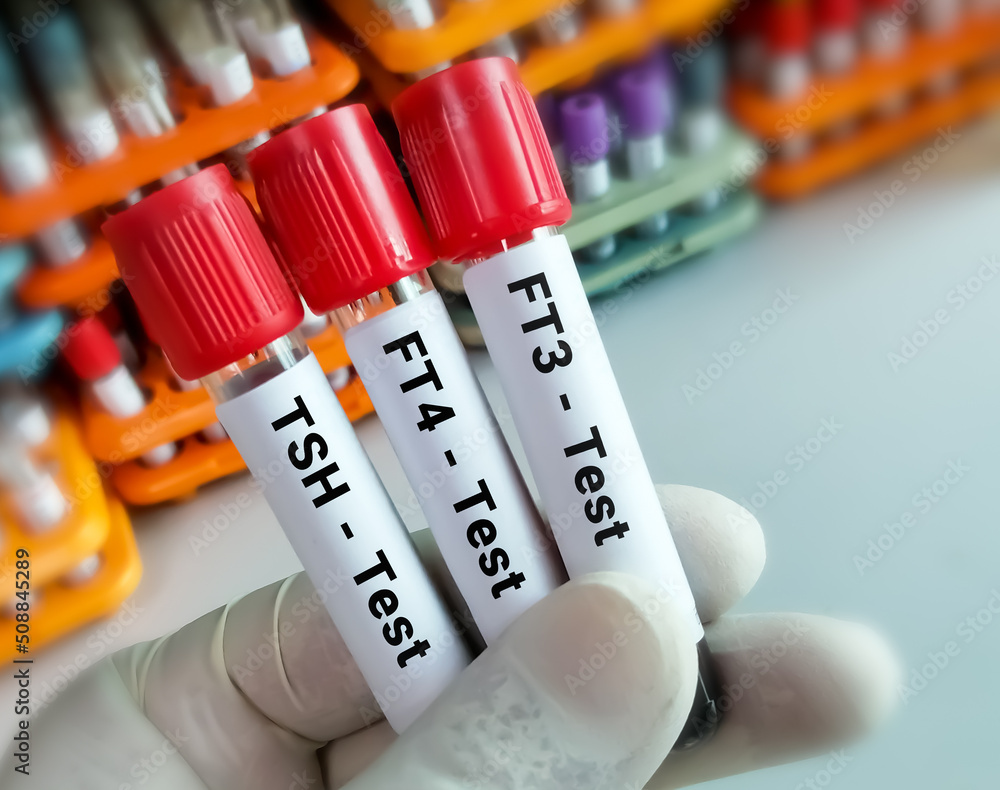Blood samples for hormonal examination of thyroid gland in laboratory ...